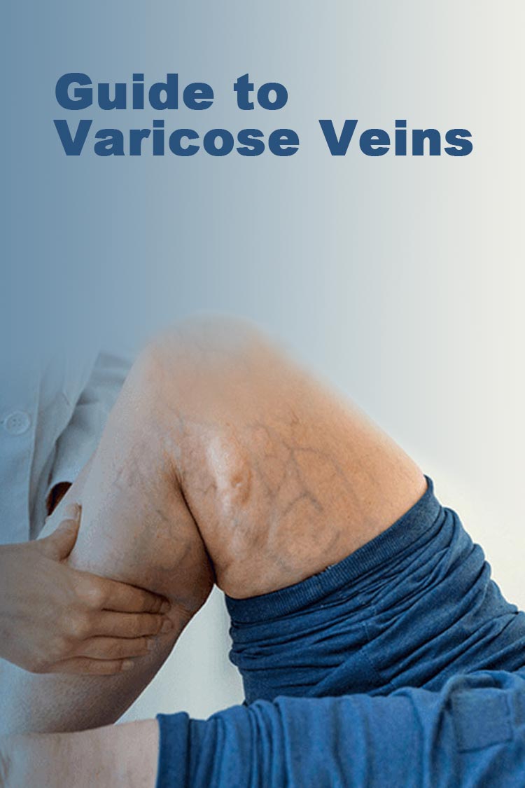 Laser Varicose Veins | Potent Medical