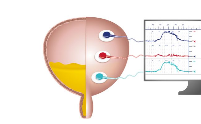 Urodynamics Test System | Potent Medical