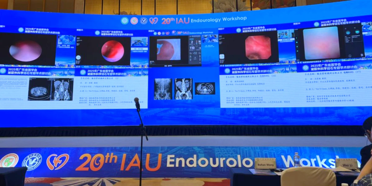 Potent’s Laser Tech Excels at 20th IAU Endourology – Potent Medical